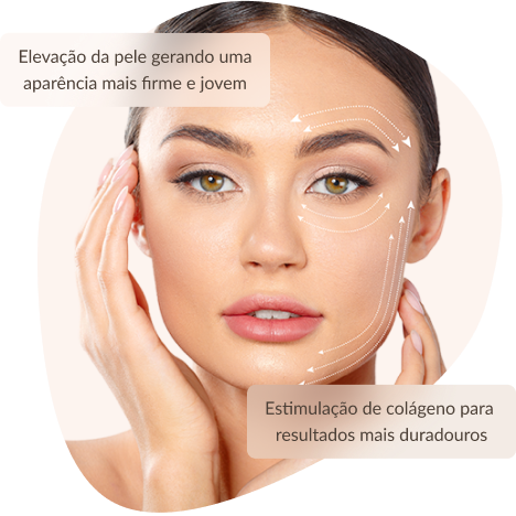 Fios de PDO na Asa Sul, Brasília/DF | Clínica Pelerine